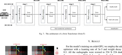 Figure 7 From Pediatric Oral Health Detection Using Swin Transformer Semantic Scholar