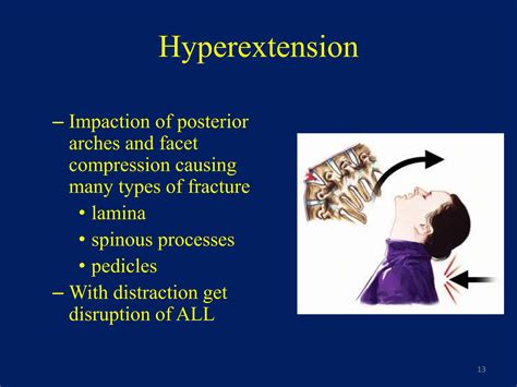 Cervical Spine Injury Antomy And Managementpptx