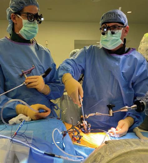 Rushs Use Of Excelsius Robot In Adult Deformity Idiopathic Scoliosis