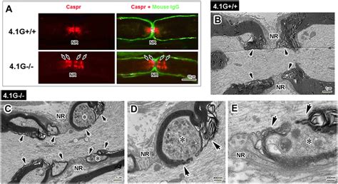 Microscopic Structure Of Paranodes Next To The Nodes Of Ranvier Nrs Download Scientific