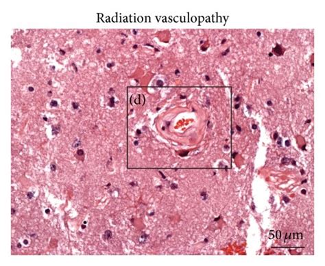 Formalin Fixed Paraffin Embedded Tissue Sections Stained With Download Scientific Diagram
