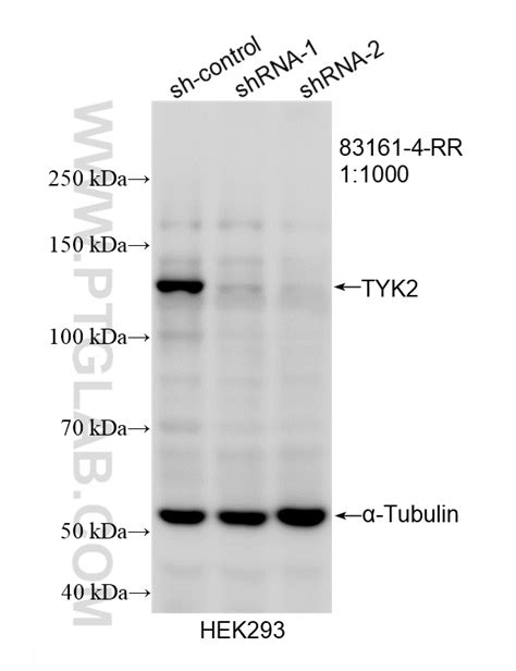 Tyk2 Antibody 83161 4 Rr Proteintech 武汉三鹰生物技术有限公司