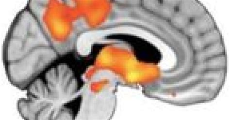 Beyond Runners High The Upside Of More Endorphin Receptors