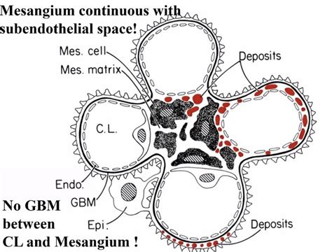 Discover And Read The Best Of Twitter Threads About Lupusnephritis