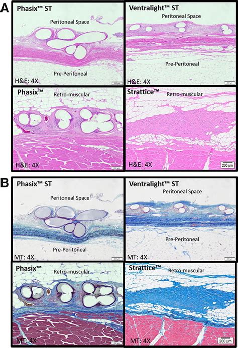 Photomicrographs Of Phasix™ St Ventralight™ St Phasix™ And Download Scientific Diagram