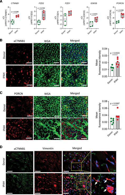 Targeting Wnt ß Catenin FOSL Signaling Ameliorates Right Ventricular