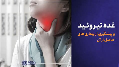 غده تیروئید و پیشگیری از بیماری های حاصل از آن مای اسمارت ژن