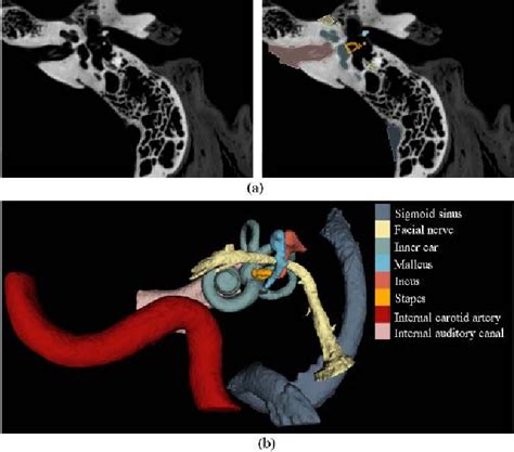 Figure 1 From Pwd 3dnet A Deep Learning Based Fully Automated Segmentation Of Multiple