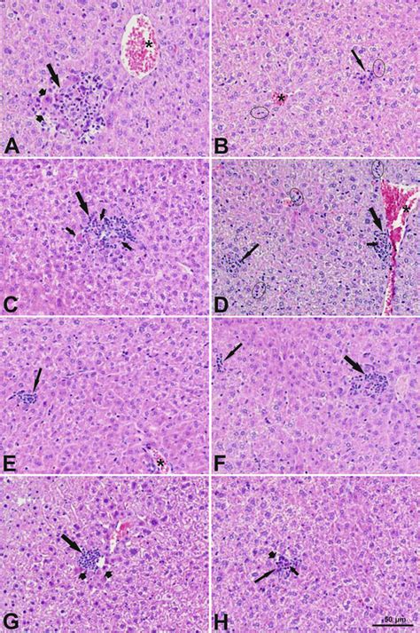 Examples Of Focal Inflammatory Cell Infiltrates In Livers Of Mice