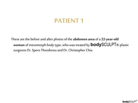 Evolve By Inmode Before And After Ppt