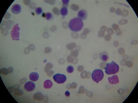 Proeritroblasto Eritroblasto Basofilico Eritroblasto Pol… Flickr