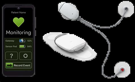 The Mome Arc® Infobionic Ais Mome Arc® Enabling The Future Of Diagnostic Remote Cardiac