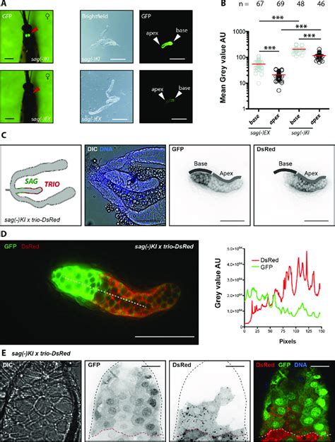Fluorescent Reporter Expression In The Median Lobe Reveals Spatial