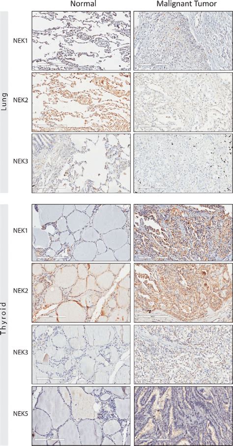 Immunohistochemistry Tissue Microarray Tma Of Specimens Of Human Download Scientific Diagram
