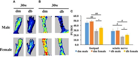 Influence Of Sex On Cognition And Peripheral Neurovascular Function In Diabetic Mice Pmc