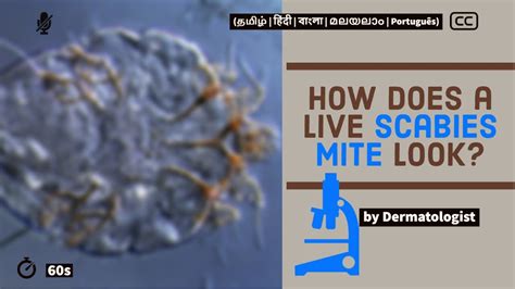 What Does Scabies Look Like Under Microscope