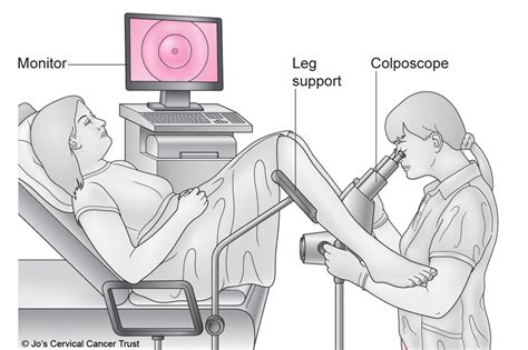 Colposcopy Em Doctors