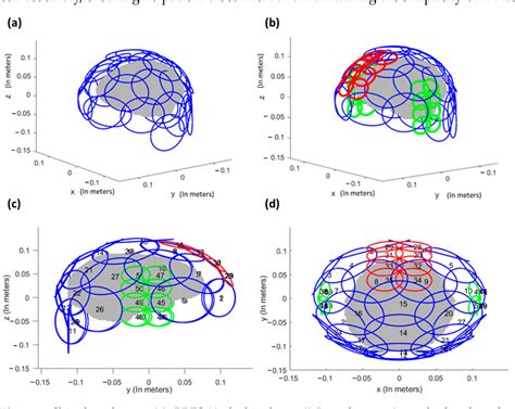 Figure 1 From Enhancing Whole Brain Magnetic Field Homogeneity For 3d Magnetic Resonance