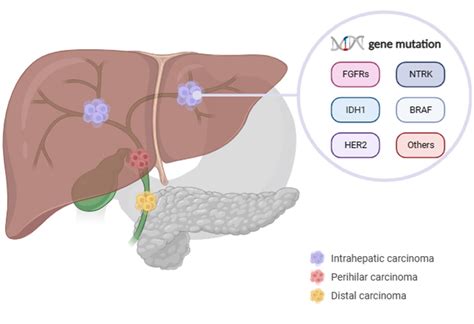 Mutation Based Therapies For Intrahepatic Cholangiocarcinoma New