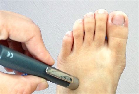 Metal Diabetes Testing Equipment Diabetic Neuropathy Testing Equipment 100 18mm