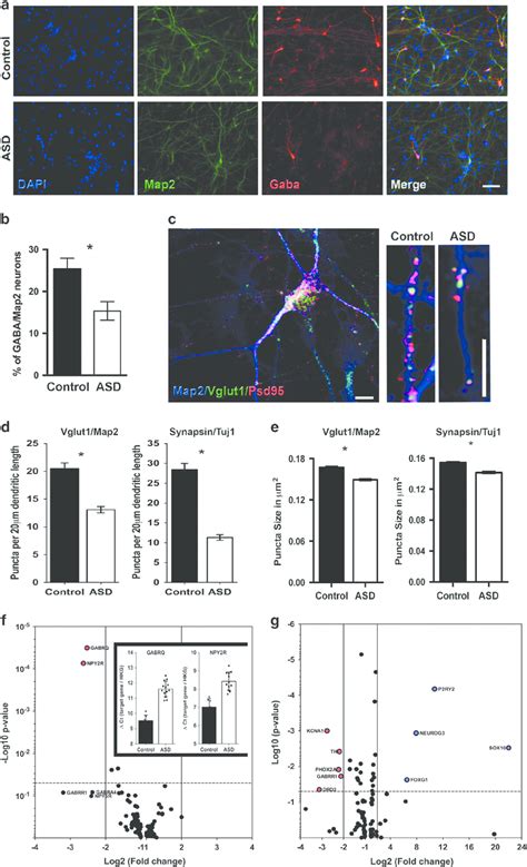 Synaptic Alterations In Autism Spectrum Disorder Asd Neuronal Download Scientific Diagram