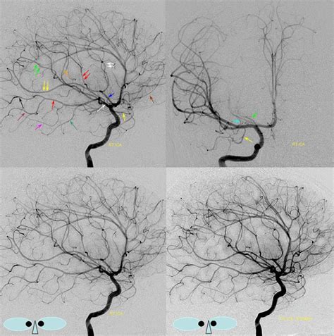 Index Of Wp Content Uploads MCA