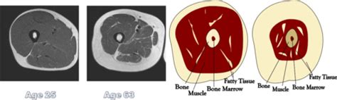 Physiology Ageing Muscle And Bone Flashcards Quizlet