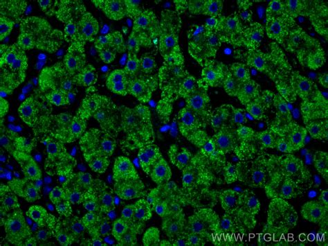 Complement Factor B Antibody 66154 1 Ig Proteintech