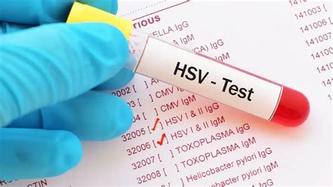 HSV 1 Vs 2 Differentiating Between The Herpes Types