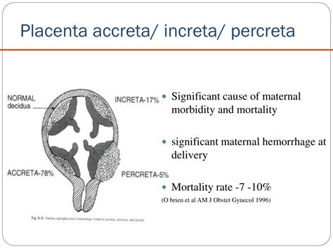 Ppt Placenta Accreta Lessons Learnt Powerpoint Presentation Free Download Id6768340