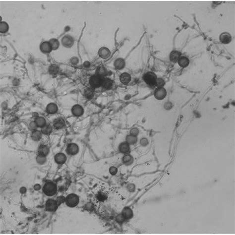 Characteristic Mycelia And Large Rounded Unicellular Tuberculate Download Scientific Diagram