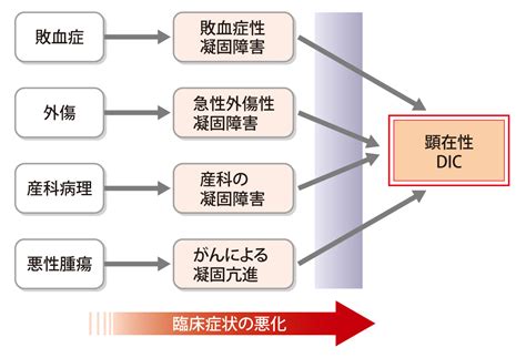医療 Dicとは 播種性血管内凝固 Dic で正しいのはどれか Eooyju