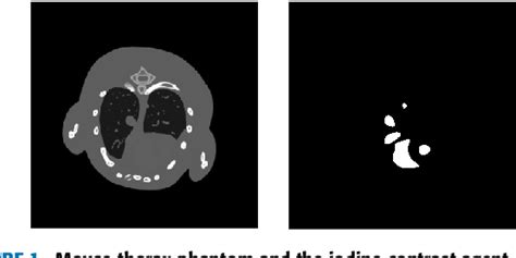 Figure 1 From Spectral Ct Reconstruction Based On Piccs And Dictionary