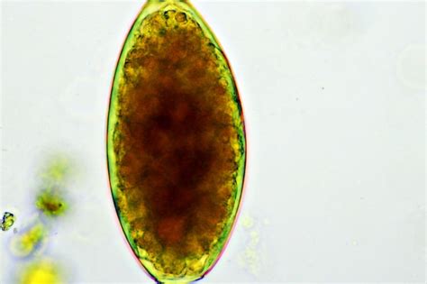 Premium Photo Understanding Preventing And Treating Trichinellosis Infections