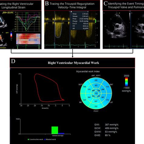 Process For Calculating Right Ventricular Myocardial Work A Evaluating Download Scientific