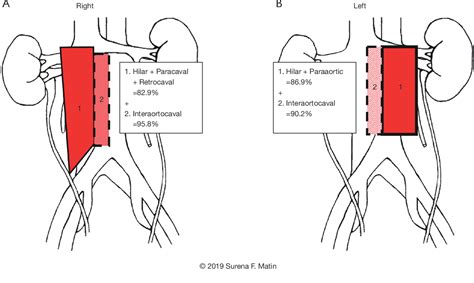 Figure 1 From Role Of Lymph Node Dissection At The Time Of Open Or