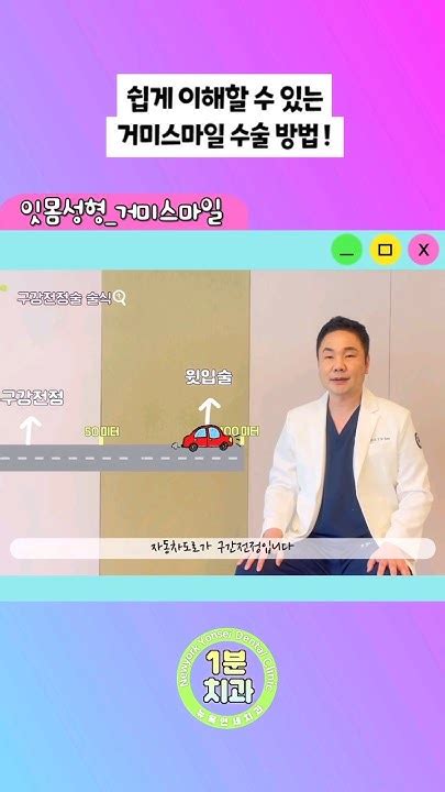 거미스마일 수술 방법 Feat구강전정술 거미스마일 Youtube