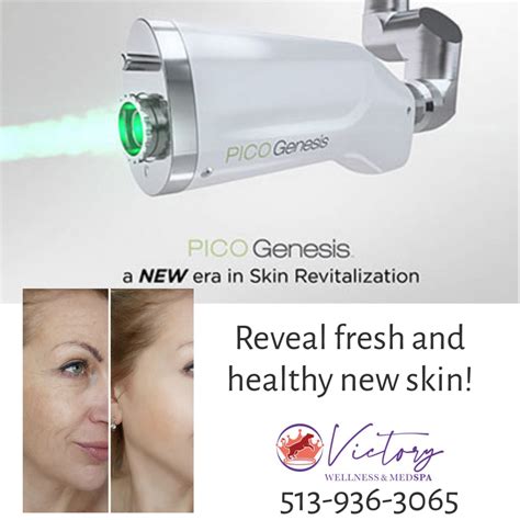 Reveal A Fresh And Healthy New Layer Of Skin With Pico Genesis Reduces Fine Lines And Wrin