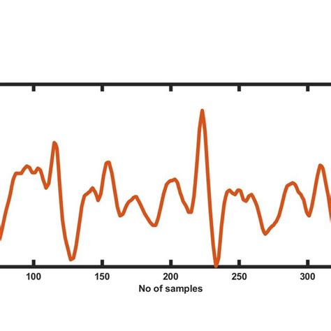 typical ht bcg signal download scientific diagram