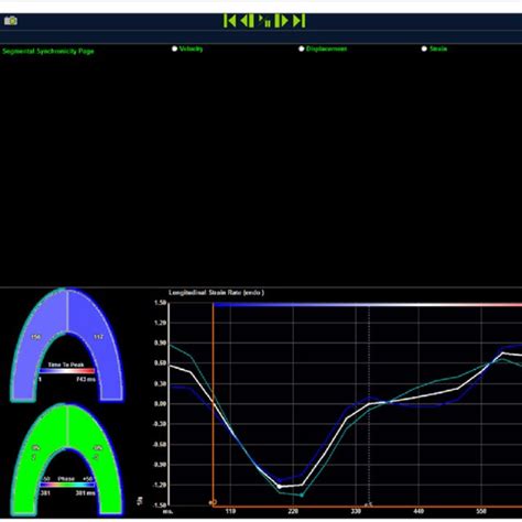 RV Strain Analysis Using The TomTec Software D Cardiac Performance