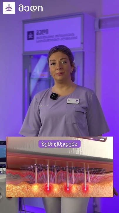 როგორ ვუმკურნალოთ ნაოჭებს აკნეს ცელულიტს მორფეუს 8 Youtube