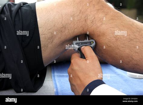 Electromyography Emg And Somatosensory Evoked Potential Pev Of Lower Extremities