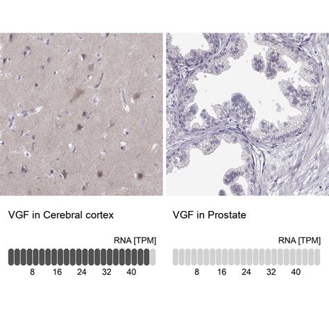 Rabbit Polyclonal Anti Vgf Antibody Buy For Research Highly