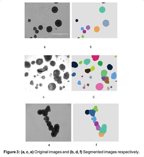 B Demonstrates That Segmentation Of Two Or Three Overlapping Spheres