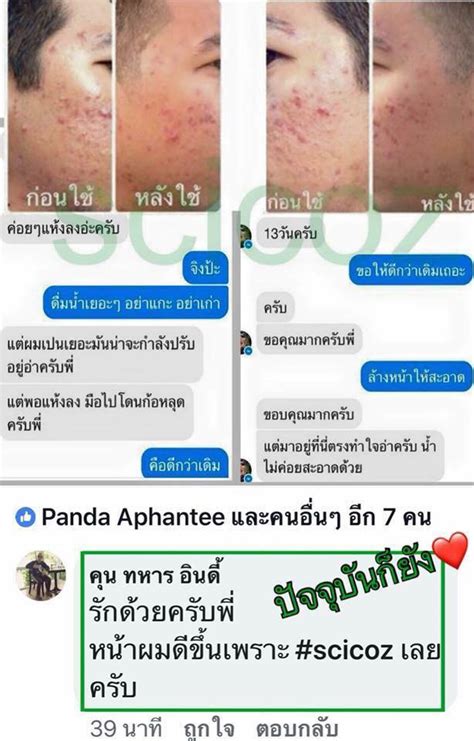 ด้านบนเป็นรูปรีวิวสมัยน้องใช้แรกๆได้13วันเองค่ะ จนปัจจุบันก็ยังใช้อยู่ 4ปีกับน้ำตบสารสกัด