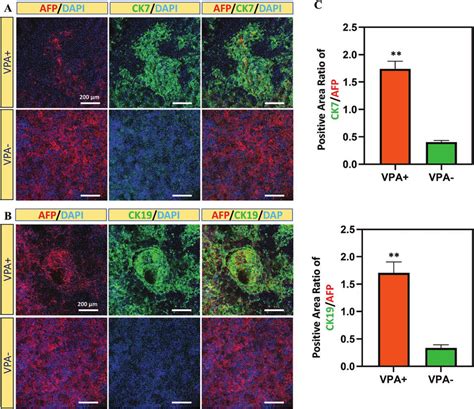 Immunostaining Of Cholangiocyte Marker Proteins In Differentiated Cells