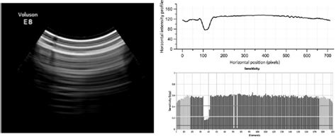 Left Reverberation Image Of The Rab4 8 D Transducer Notice The Loss