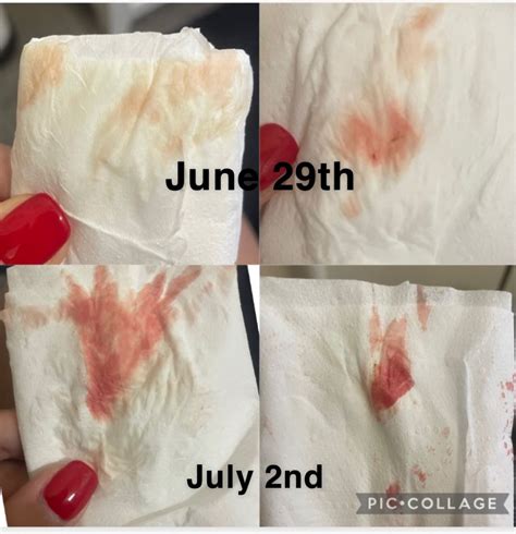 Why Spotting Instead Of Period