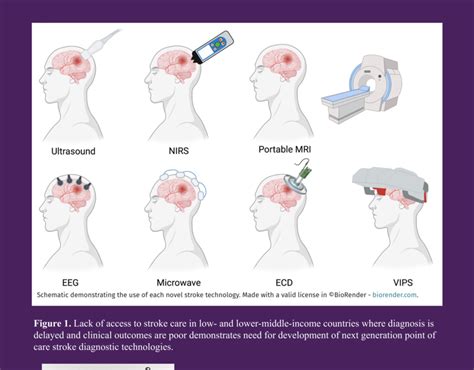 Given The Need For Rapid Portable Stroke Diagnostic Technology Our Download Scientific