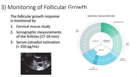Assisted Reproductive Technologies Art Pptx